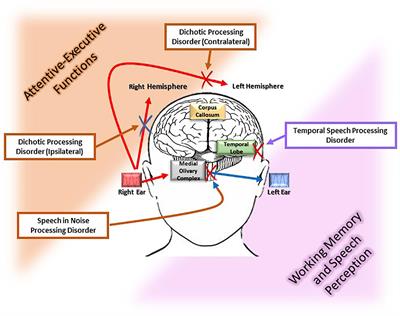 Frontiers | The Age-Related Central Auditory Processing Disorder: Silent Impairment of the ...